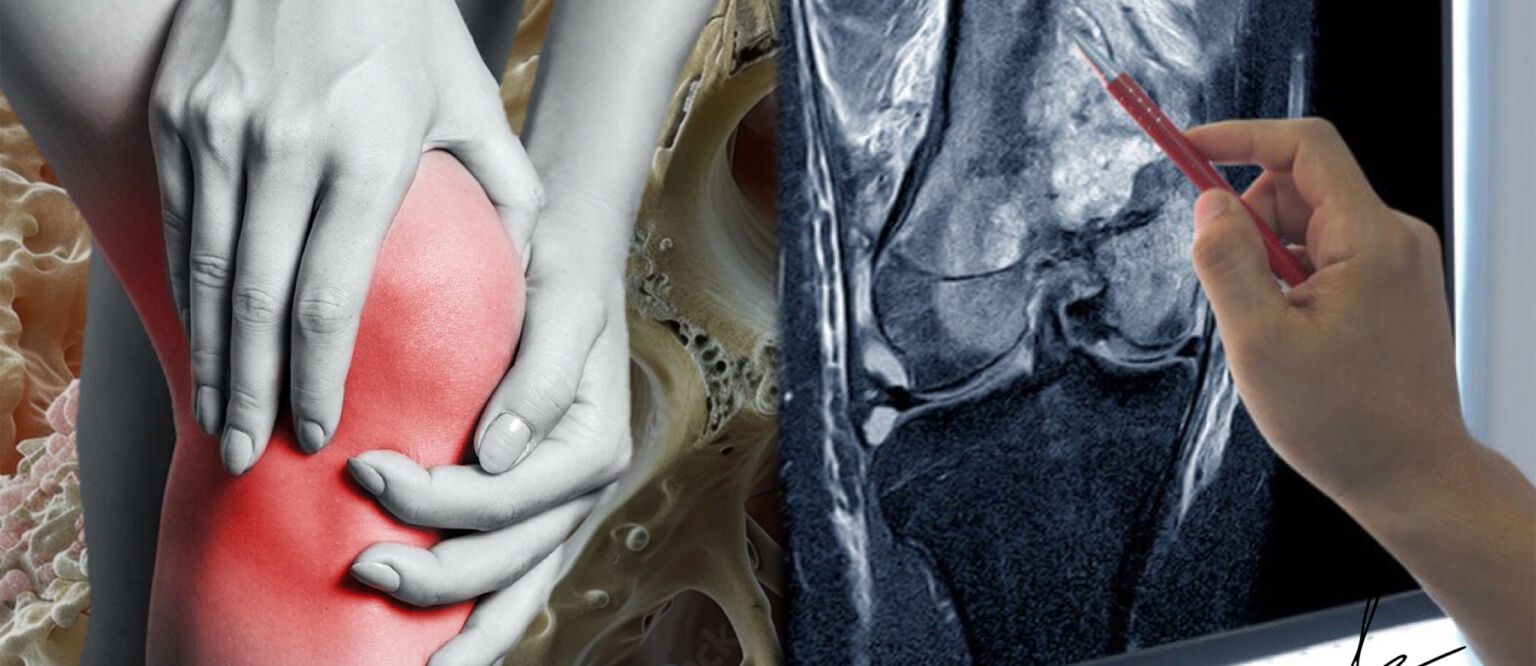 MOC - Diagnosis, treatment and innovative strategies in the surgery of ...